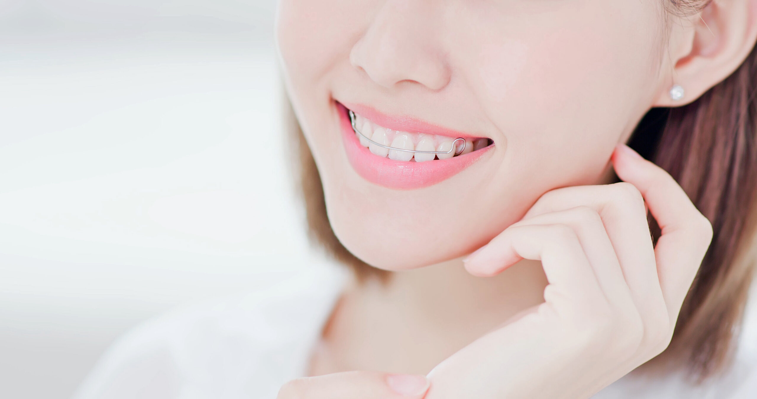 What To Know About Wearing A Retainer - Melbourne Orthodontics