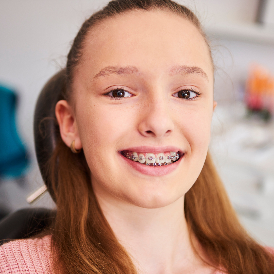 Top Foods to Eat When You Have Braces