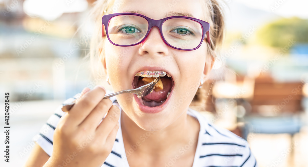 Eating Right During Orthodontic Treatment: 5 Tips for a Balanced Diet ...