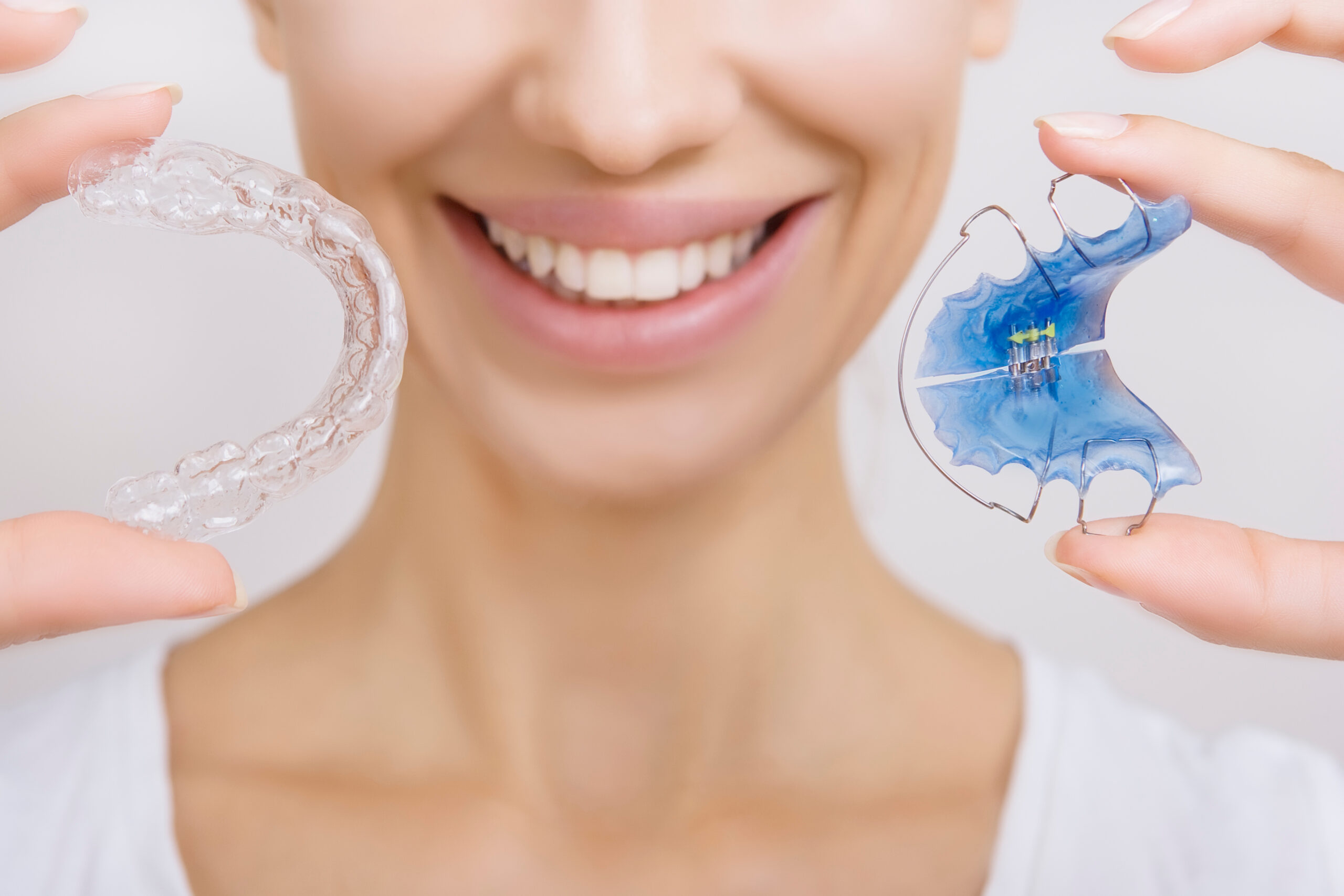 Different Types of Retainers and How to Determine Which One is Right ...
